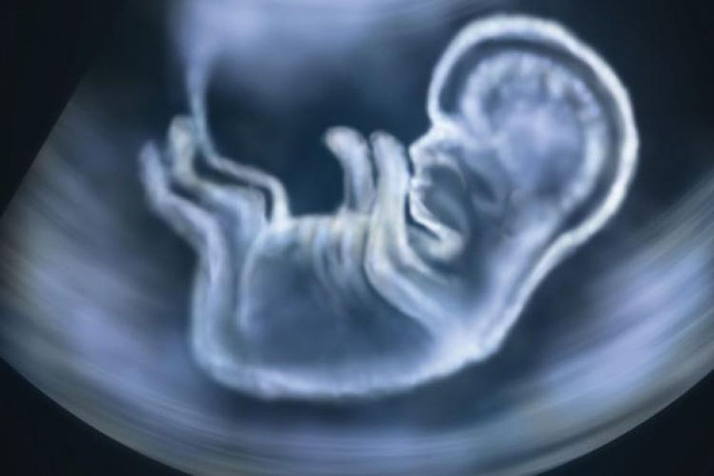 Female Foeticide Infanticide