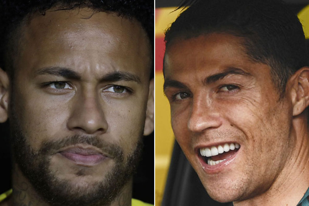 Ronaldo Teeth Before After